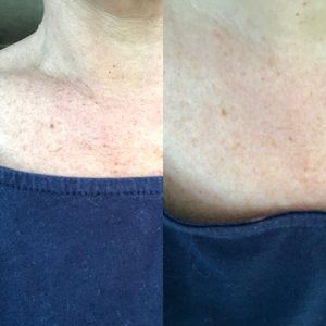 Anthropologie | Tops | Anthropologie Tla Longsleeve Blue Shirt Size M ...